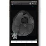 eRAD Pacs Solution | PACS Systems | Dicom Solutions