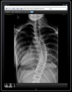 Konica Opal-RAD MiniPACS | MiniPACS Systems | Dicom Solution
